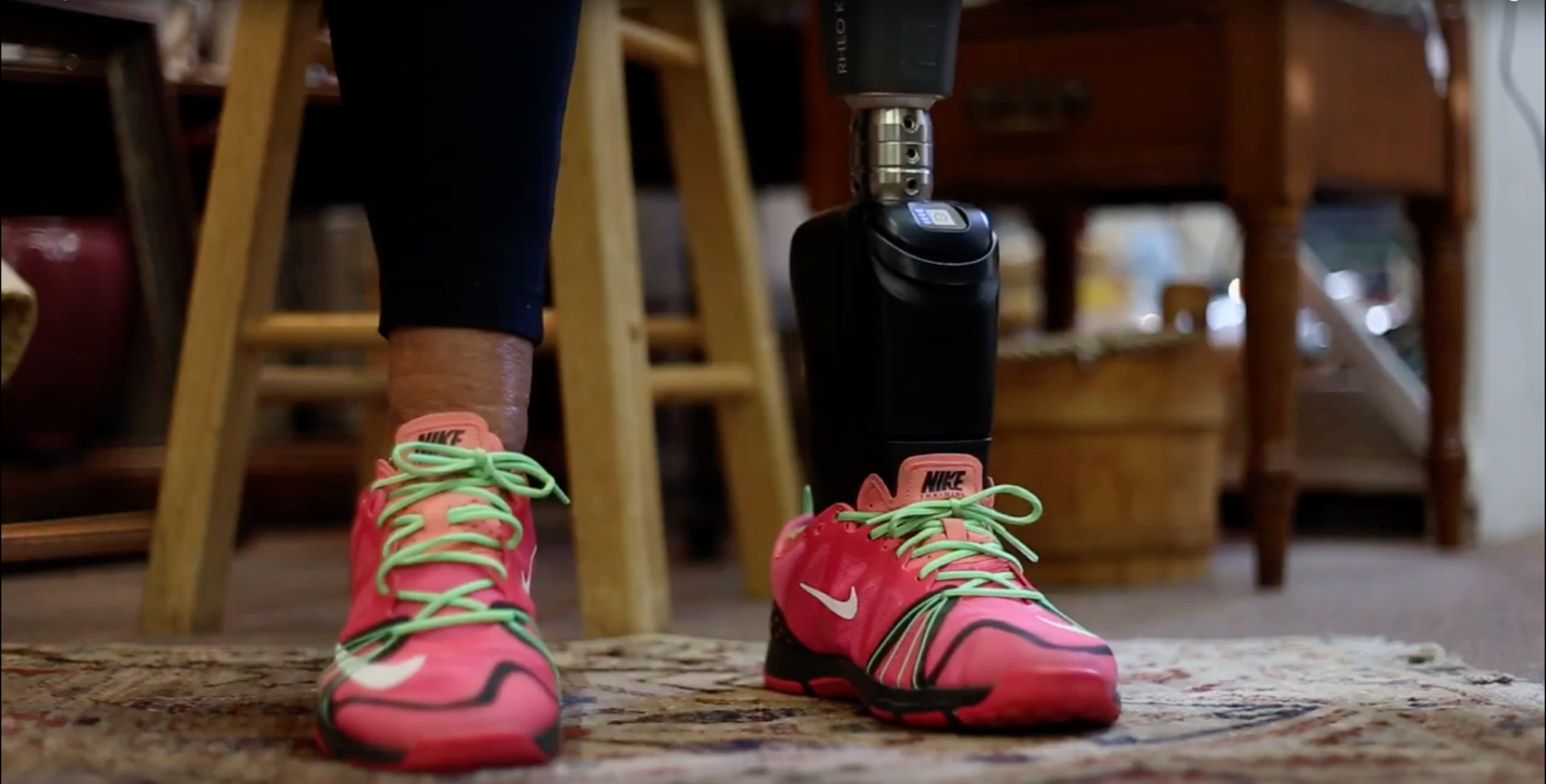 BionX emPOWER Robotic Prosthetic | Manta Product Development